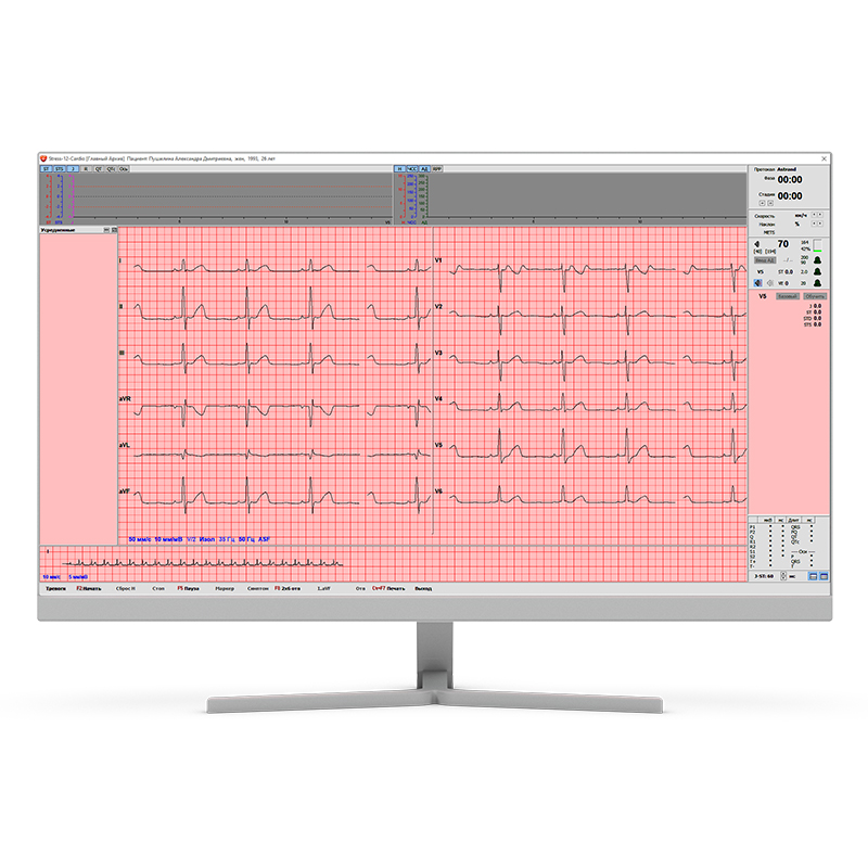 Stress ECG «Stress-12-Cardio»